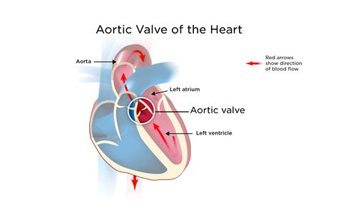 Aortic Heart Valve Disorders My Doctor Online
