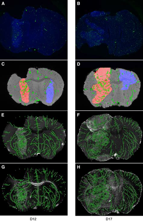 Comparison Of Histology And μmri Vascular And Diffusion Data