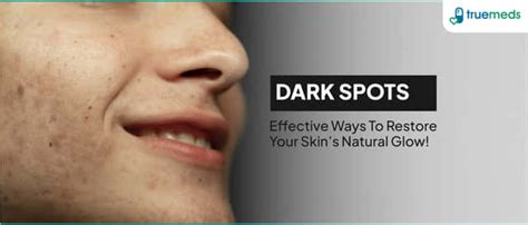 Dytor E 10 25 Mg Combi Kit Order Dytor E 10 25 Mg Combi Kit Tablet