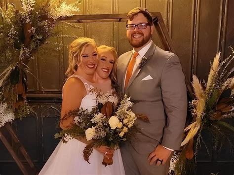 Друга чекає на свою чергу Одна з сіамських близнят вийшла заміж