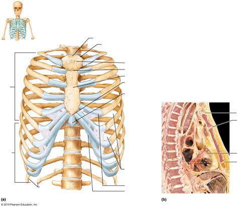 Lab 1 Exam Sternum Sacrum Hyoid Anatomy Physiology Axial Skeleton Lab