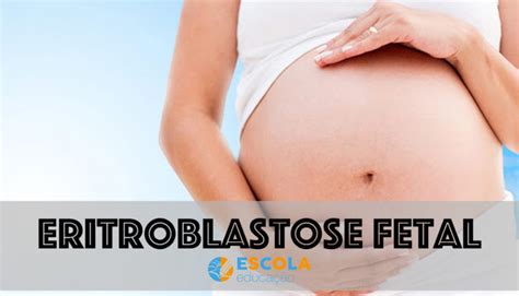 Eritroblastose Fetal Resumo O Que é Sintomas Prevenção Tratamento