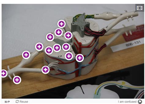 Aandp Lab Practical 2 Spinal Cord Diagram Quizlet
