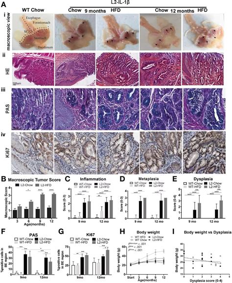 Gastroenterology高脂饮食通过IL8加速Barrett食管小鼠模型的癌变并改变肠道微生物组 凤凰网