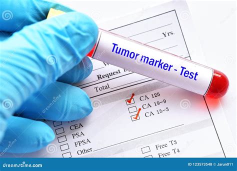 Blood Sample Tube For Tumor Marker Test Stock Photo Image Of Ca Glycoprotein