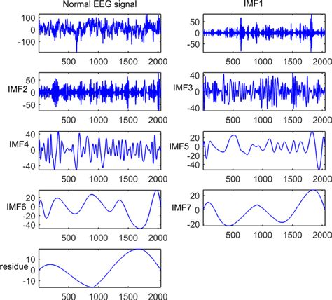 plot of normal eeg signal with its imfs obtained by emd with csi emd