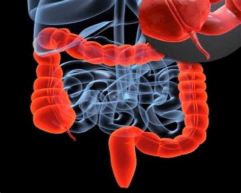 All You Need To Know About Appendix Operation Clicko Health