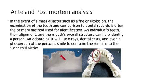 Forensic Dental Identification