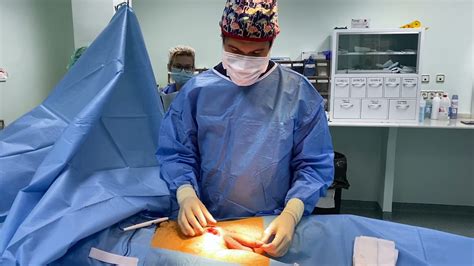 Can You Get Surgery To Make Your Big Toe Smaller At Hipolito Milsap Blog