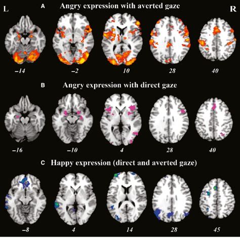 Whole Brain Results Patterns Of Whole Brain Activity During The