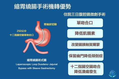 賀國際代謝形體醫學中心黃致錕院長發明縮胃繞腸手術榮獲第18屆國家新創獎新創醫療技術臨床新創獎 最新消息 中國醫藥大學附設醫院
