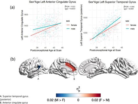 Sex Differences In Human Brain Structure At Birth Pmc