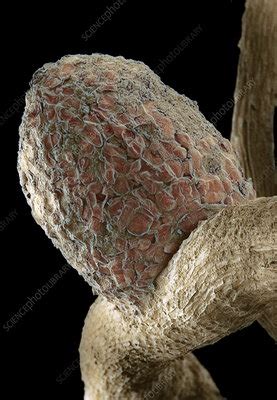 Root Nodule Stock Image B Science Photo Library