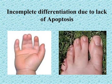 Apoptosis Ppt