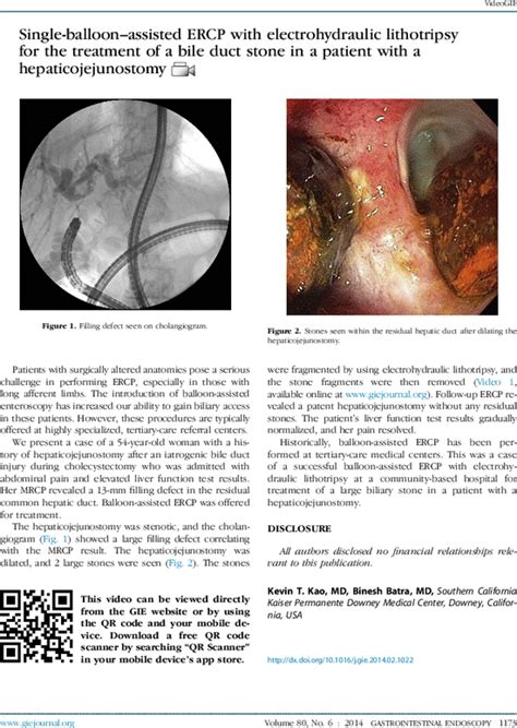 Single Balloonassisted Ercp With Electrohydraulic Lithotripsy For The