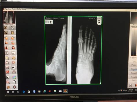 Talented And Expensive Feet 1010 Park Place