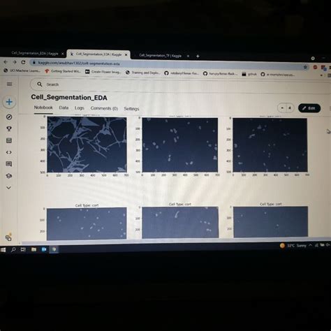 Anubhav Singh On Linkedin Kaggle Computervision Tensorflow