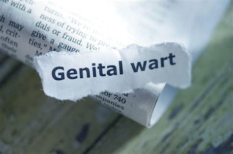 Some Facts About Genitalwarts 🔸genital Warts Are One Of The Most Common Forms Of Sexually