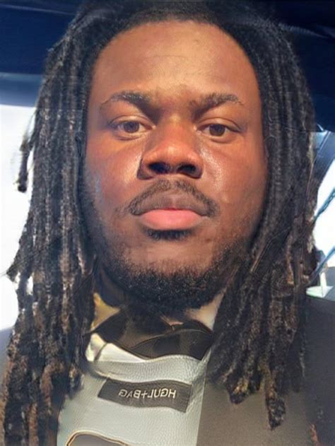 Rease Took The Hair Treatments Too Far He Ate Multiple Philly