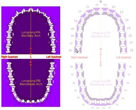 Panduan Lengkap Pengisian Odontogram Langkah Demi Langkah Info Drg