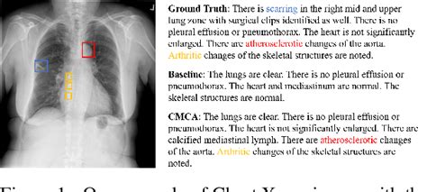 Figure 1 From Cross Modal Contrastive Attention Model For Medical Report Generation Semantic