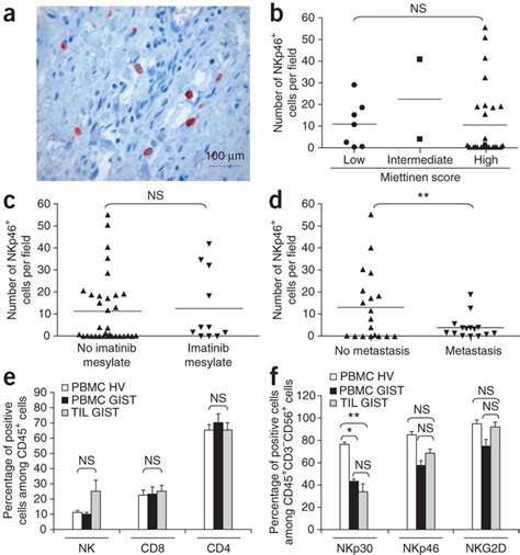 Nkp46 Til Infiltrates In Gist Inversely Correlate With Metastases At