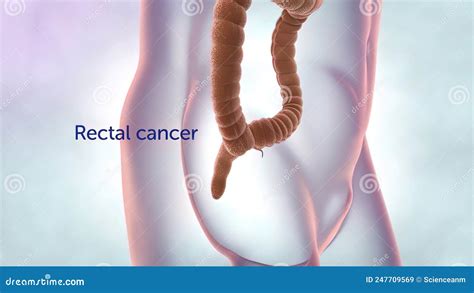 Colon Rectum And Anus Anus Function Anatomy Conditions And Diagram