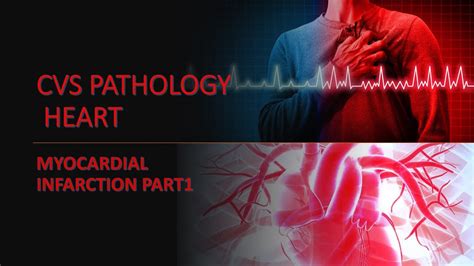 Myocardial Infarction Part 1 Youtube