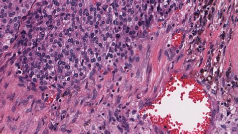 使用 Cucim 和 Nvidia Gpudirect 存储加速数字病理工作流程 Nvidia 技术博客