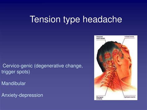 Ppt Headache Powerpoint Presentation Free Download Id182479