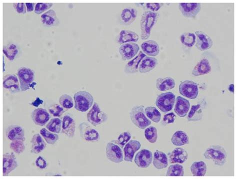 Bone Marrow Derived Eosinophil Cultures Pmc