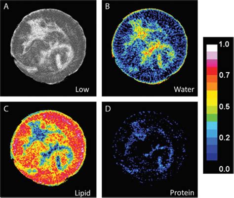 Material Decomposition Spectral Photon Counting Computed Tomography