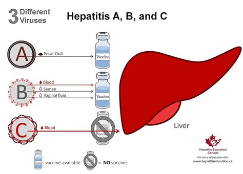 Difference Between Hepatitis And Fatty Liver At Howard Vasquez Blog