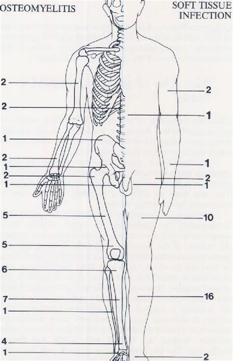 14 Review Ofthe Treatments With Gentamicin Pmma Beads During The Period Download Scientific
