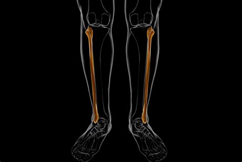 Fibula Stress Fracture The Radiology Assistant Stress Fractures