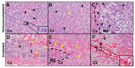 Histopathological Analysis Of Adrenal Glands After Simian Varicella Virus Infection Abstract