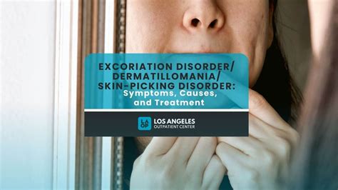 Excoriation Disorder Dermatillomania Skin Picking Disorder Symptoms