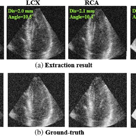 An Example Of Standard Plane Extraction Synthetic Dataset Noise