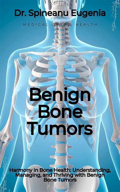 Amazon Com Benign Bone Tumors Harmony In Bone Health Understanding