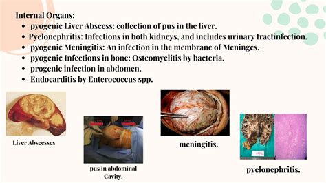 Pyogenic Infection By Tharanisham 202404250724150000pdf
