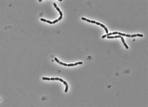 El ‘lactobacillus Rhamnosus Mejora La Lesión Hepática Crónica Por Alcohol