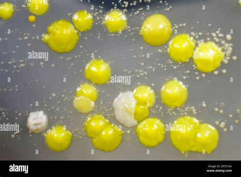 Bacteria Grown From Skin Smear Colonies Of Micrococcus Luteus And Staphylococcus Epidermidis On