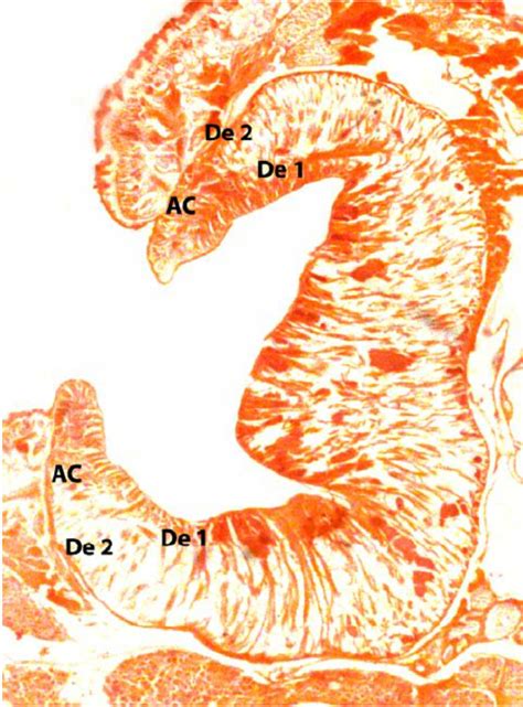 Mediosagittal Section Of Acetabulum Download Scientific Diagram