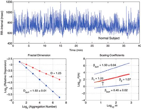 Non Linear Time Series Analysis Upper RR Interval Time Series Of