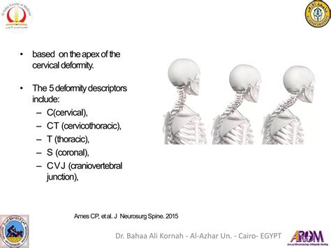 Cervical Spine Deformity Bahaa Ppt