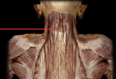 Gross Anatomy Lab Flashcards Quizlet