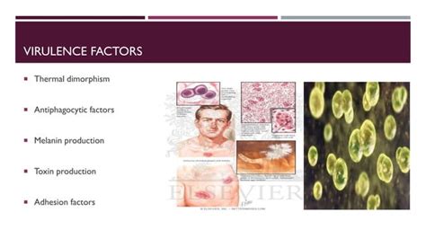 Blastomycosis Pdf Infectious Diseases Diseases And Conditions