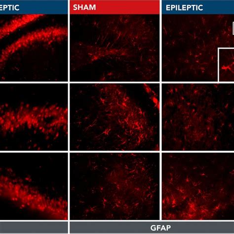 Expression Of Cell Markers Associated With Neurons Neuronal Nuclear