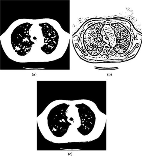 Applying Thresholding Methods On Obtained Image After Gaussian Blur Download Scientific Diagram
