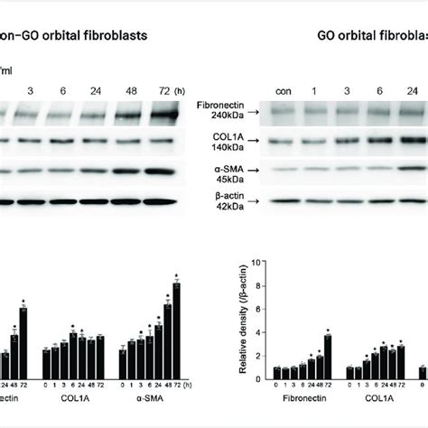 Effect Of Transforming Growth Factor Tgf β1 On Fibrosis Related Download Scientific Diagram